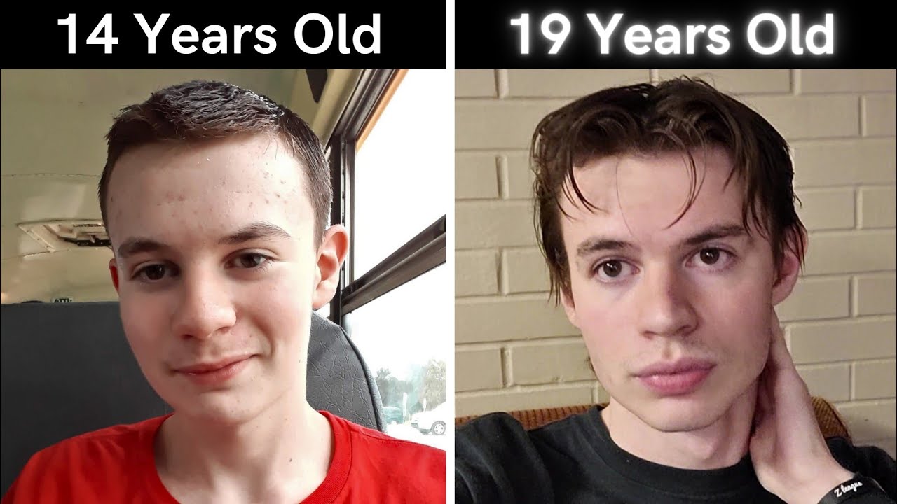 My Incredible 5-Year Face Transformation (High School to College) - YouTube