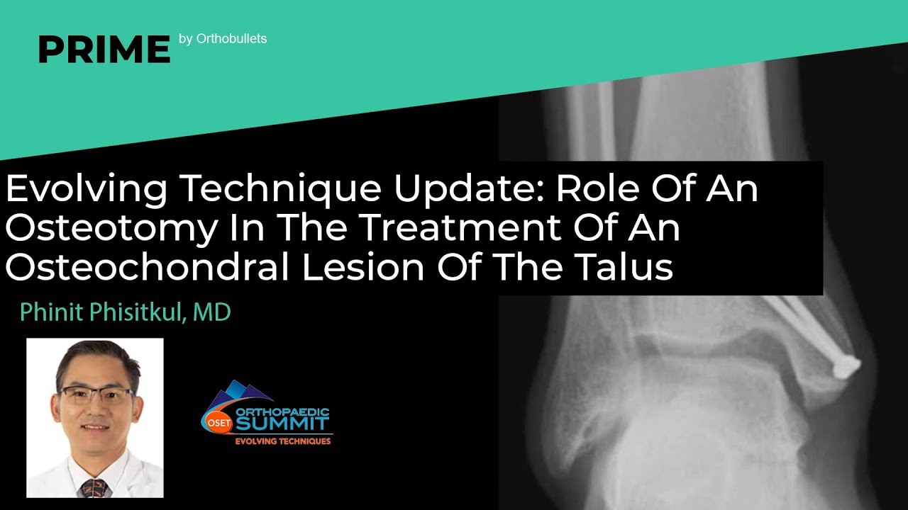 Role Of An Osteotomy In The Treatment Of An Osteochondral Lesion Of The ...