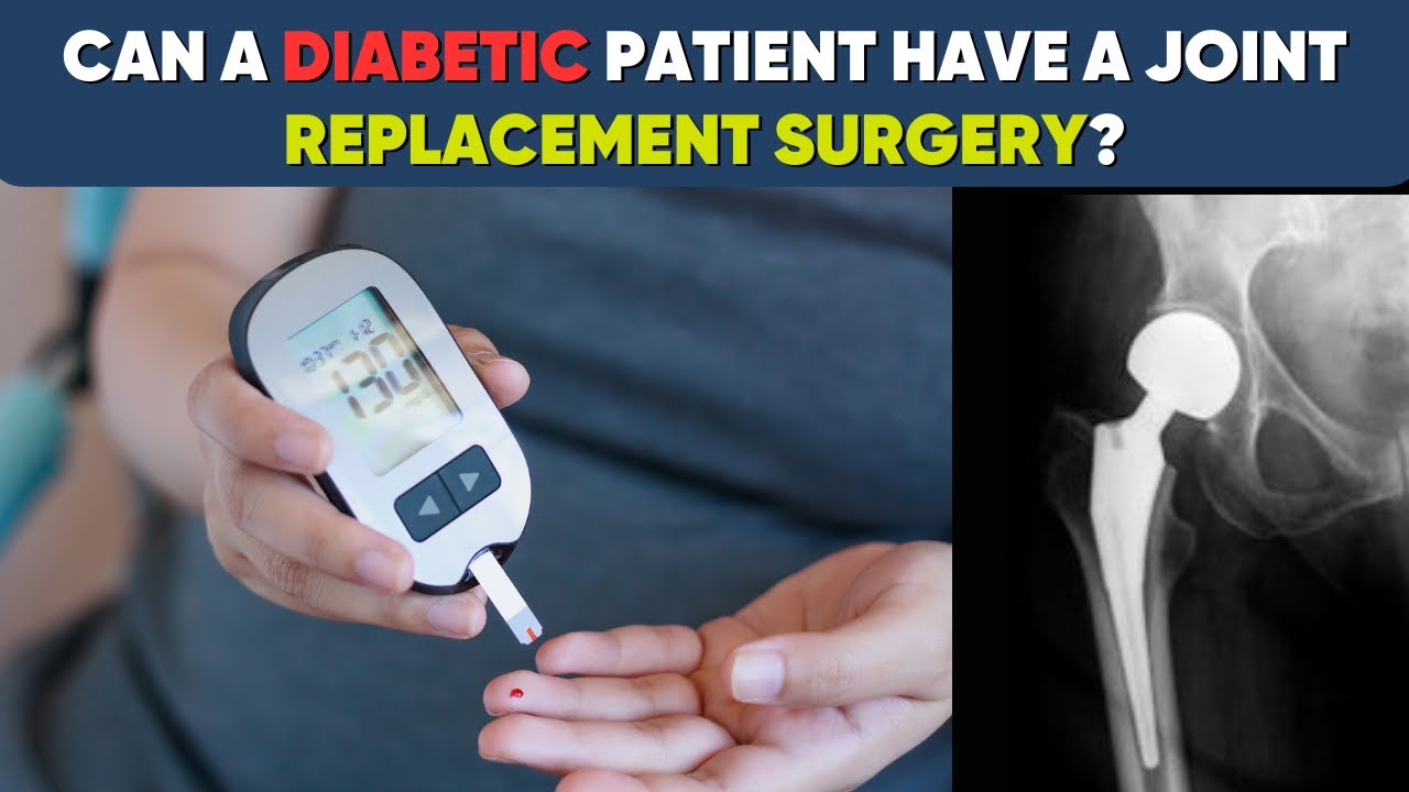 Can diabetic Patients have joint replacement surgery?Whats the best ...