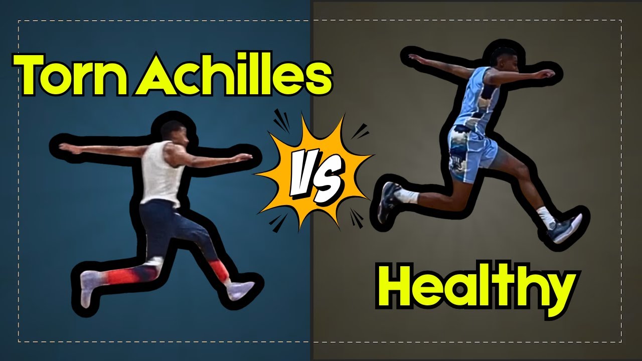 Did Tearing My Achilles Change My Jump Techinque? - YouTube
