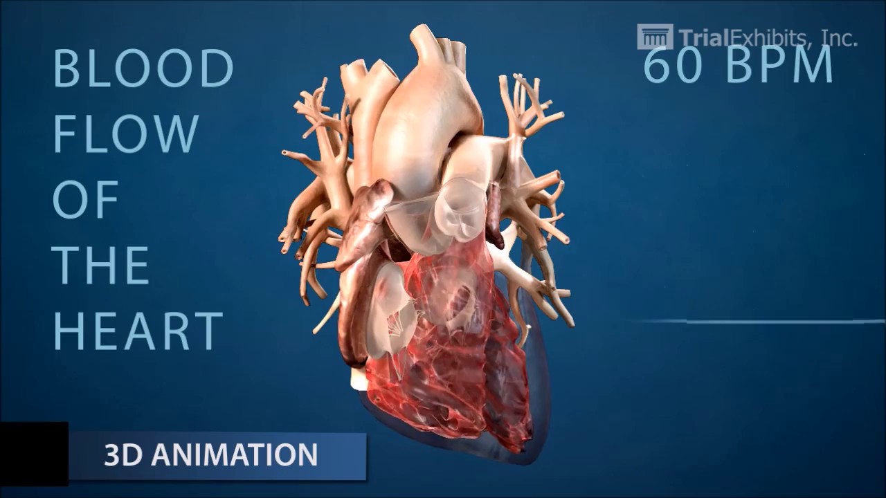 Medical Malpractice Animation - Demo - YouTube