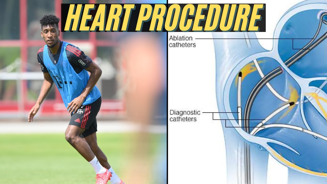 Expert Explains Kingsley Coman Heart Procedure | How Risky Is It? - YouTube