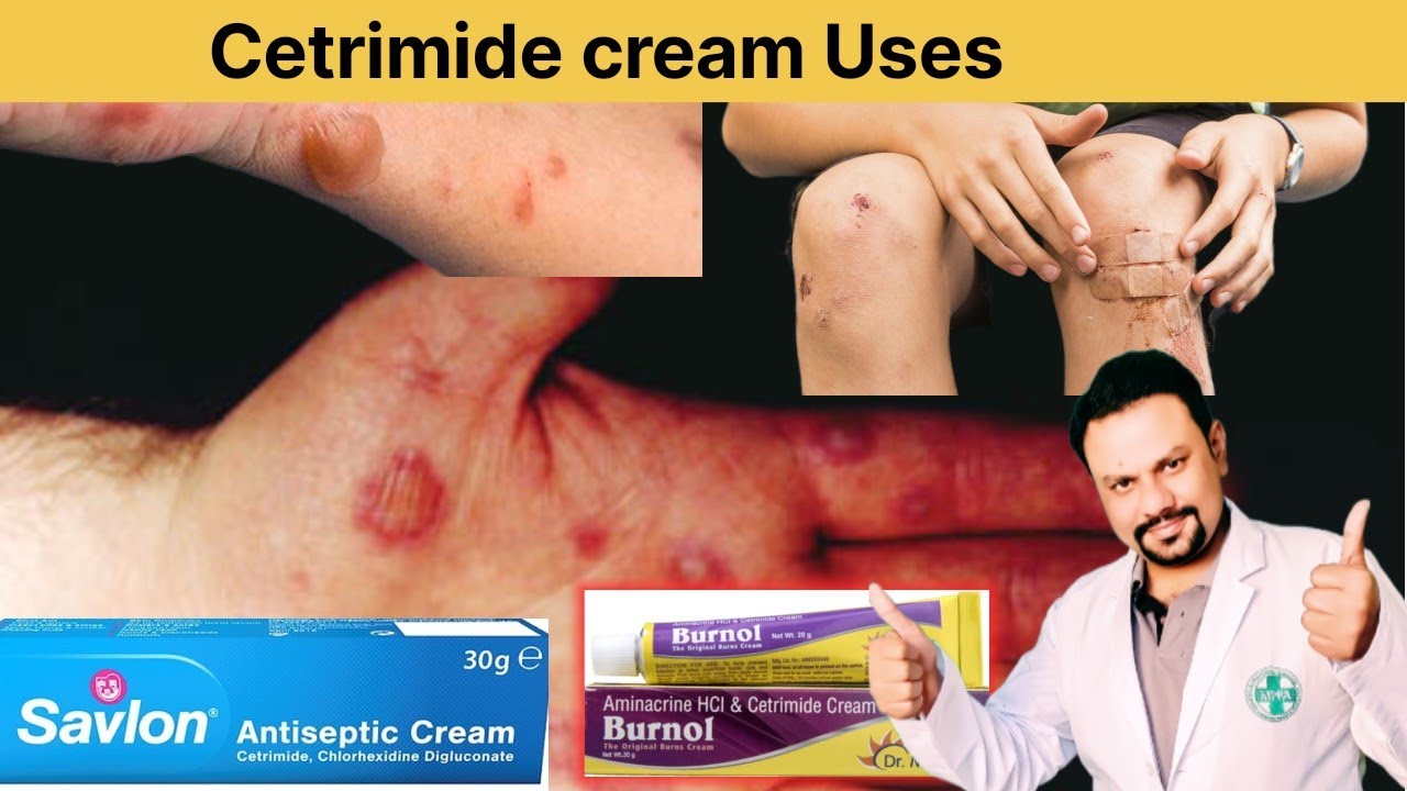 Uses of Cetrimide cream,#savloncream,#burnloncream - YouTube