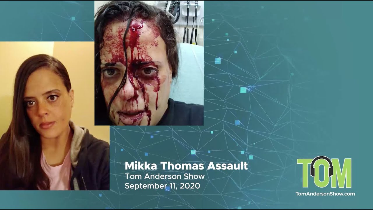 Mikka Thomas Assault / Tom Anderson Show (9-11-20) - YouTube