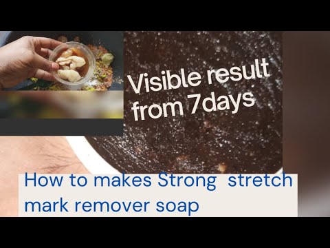 #stretchmarksoap #skincare #whitening Effective Stretch Mark Soap/How ...