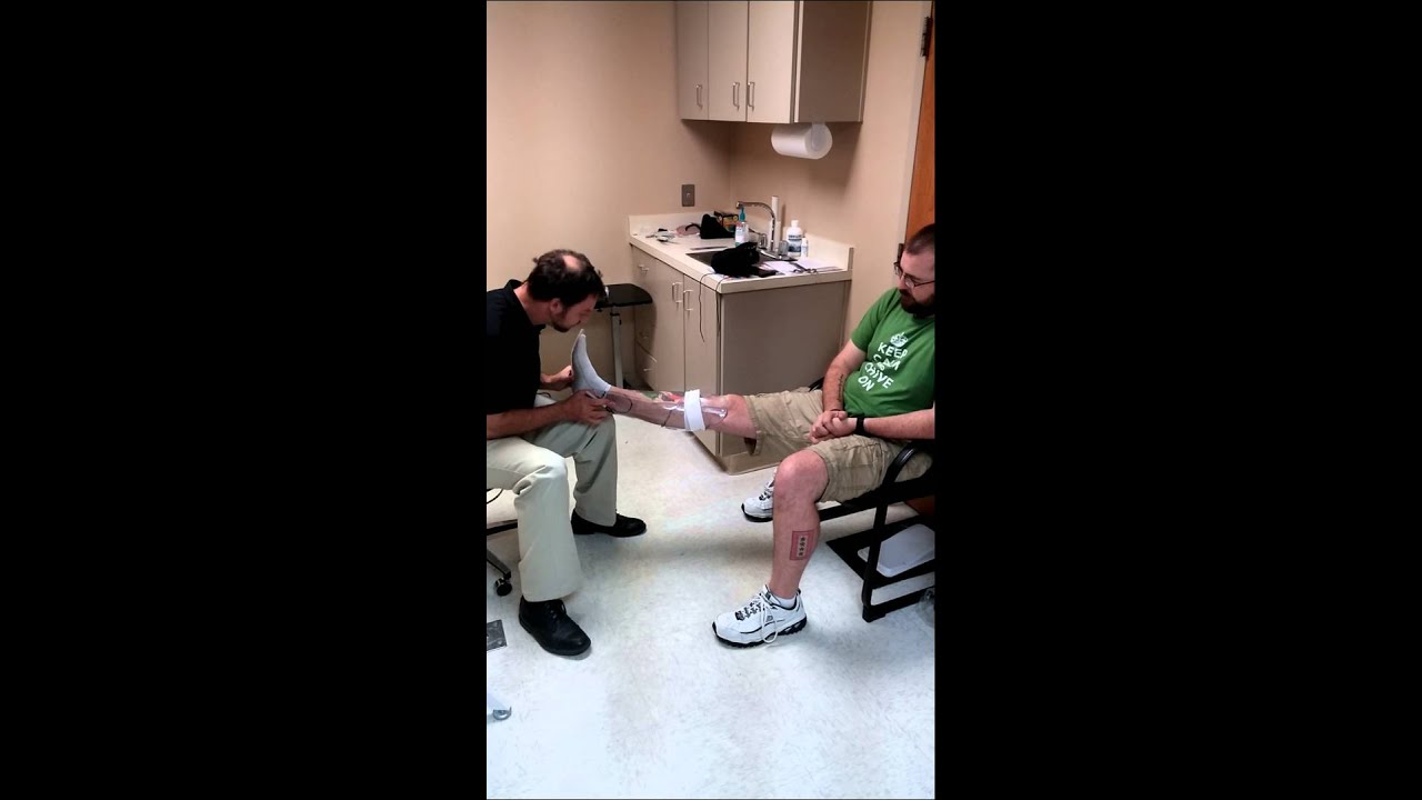 IDEO brace 2nd casting - YouTube