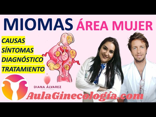 Miomas Causas Sintomas Y Tratamiento - Infoupdate.org