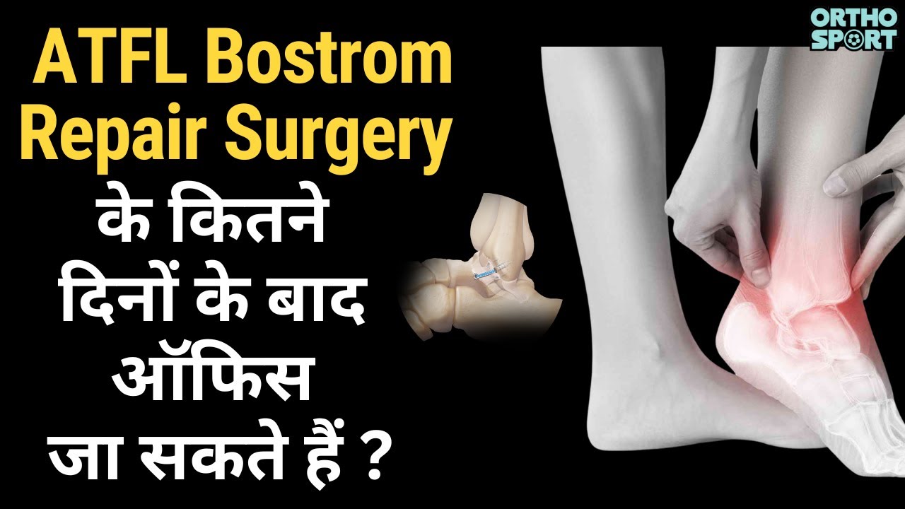 ATFL Bostrom Repair Surgery के बाद आप कितने दिनों के बाद ऑफिस जा सकते ...