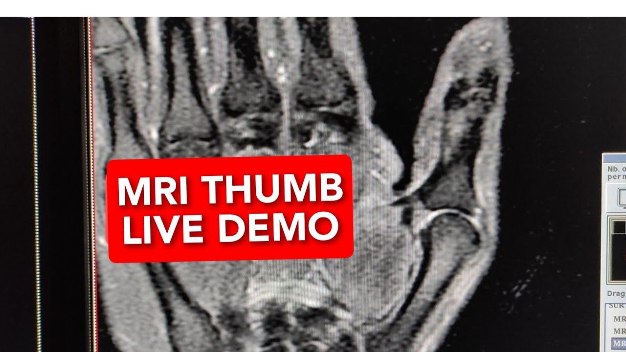 Thumb MRI scan protocol, positioning and planning on GE 1.5 Tesla ...