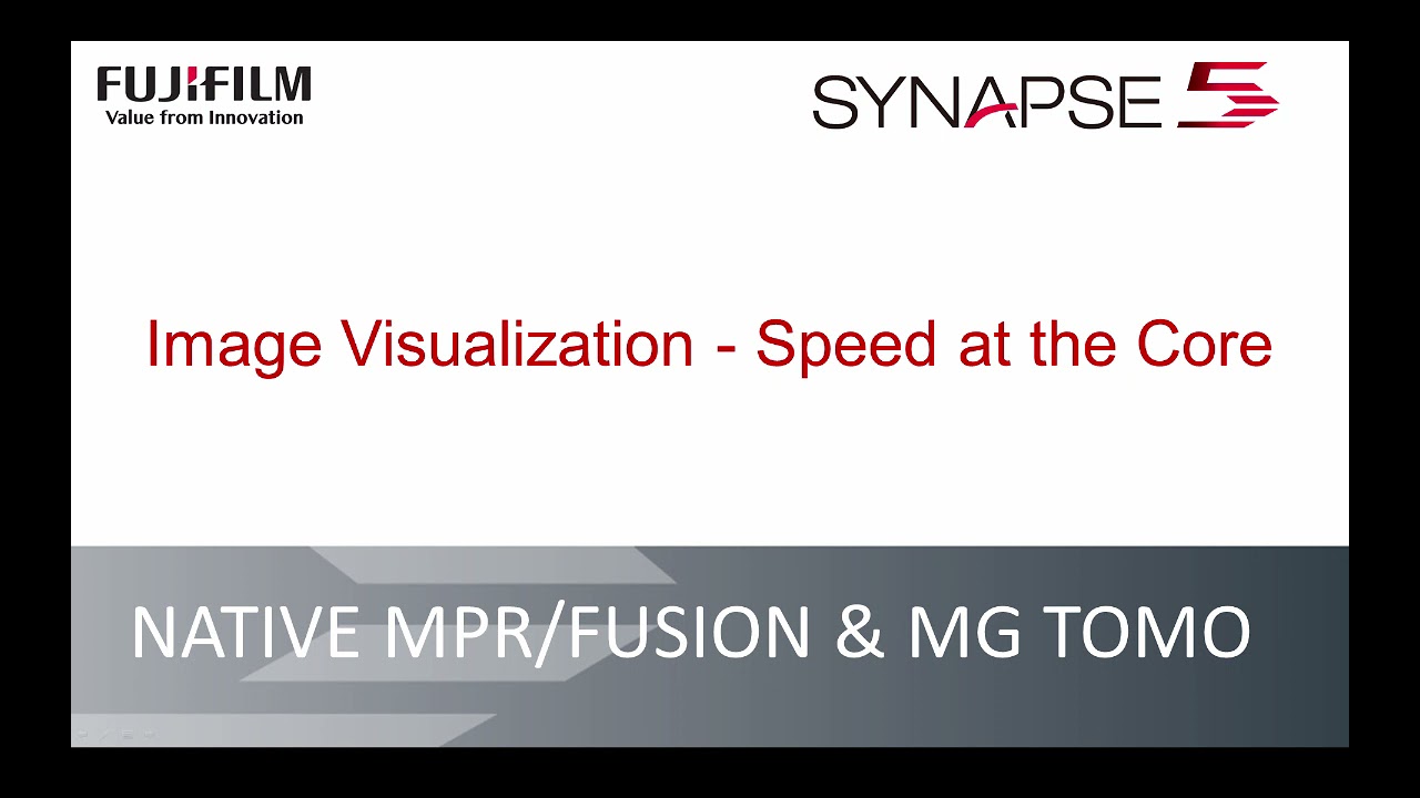 Synapse 5 eBrochure - YouTube