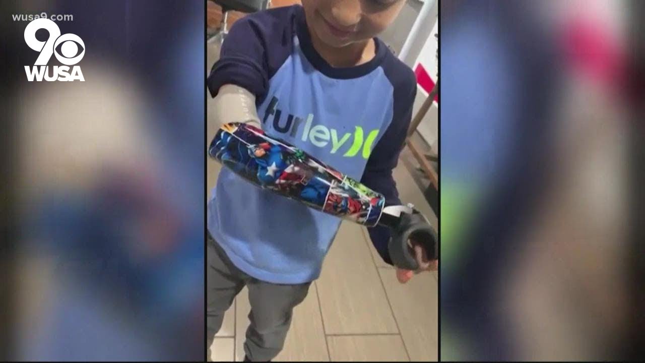 California artist creates unique prosthetics for kids - YouTube