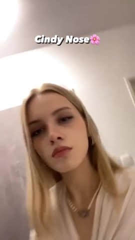 Cindy Nose Job in Turkey | Op.Dr.Harun Acıpayam - YouTube