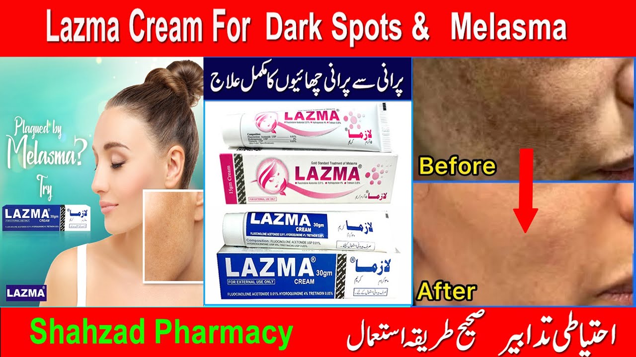 Lazma Cream Review | Lazma Cream For Skin | Lazma Cream Uses/Side ...