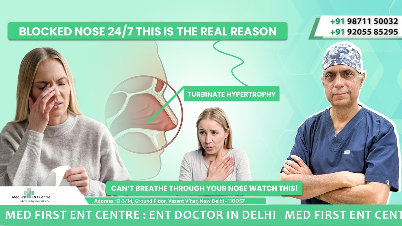 Turbinate Hypertrophy Treatment | Blocked Nose All the Time | Constant ...