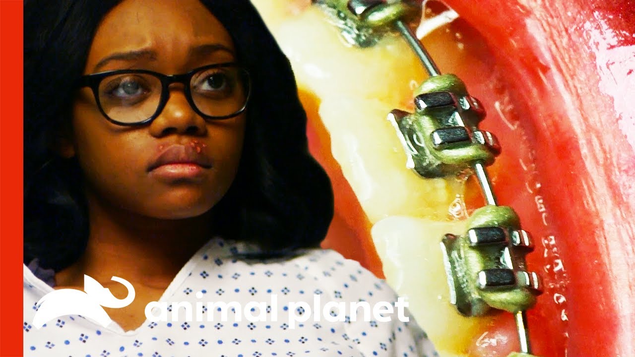 My Braces Could Have Killed Me | Monsters Inside Me - YouTube