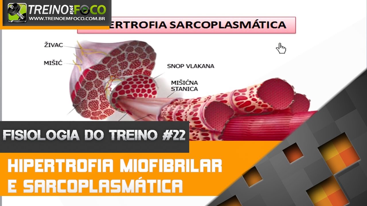 Hipertrofia Miofibrilar e Hipertrofia Sarcoplasmática - Fisiologia do ...
