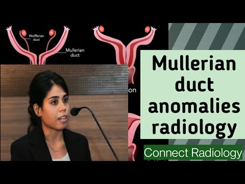 Mullerian duct anomalies radiology - PART-1 - YouTube