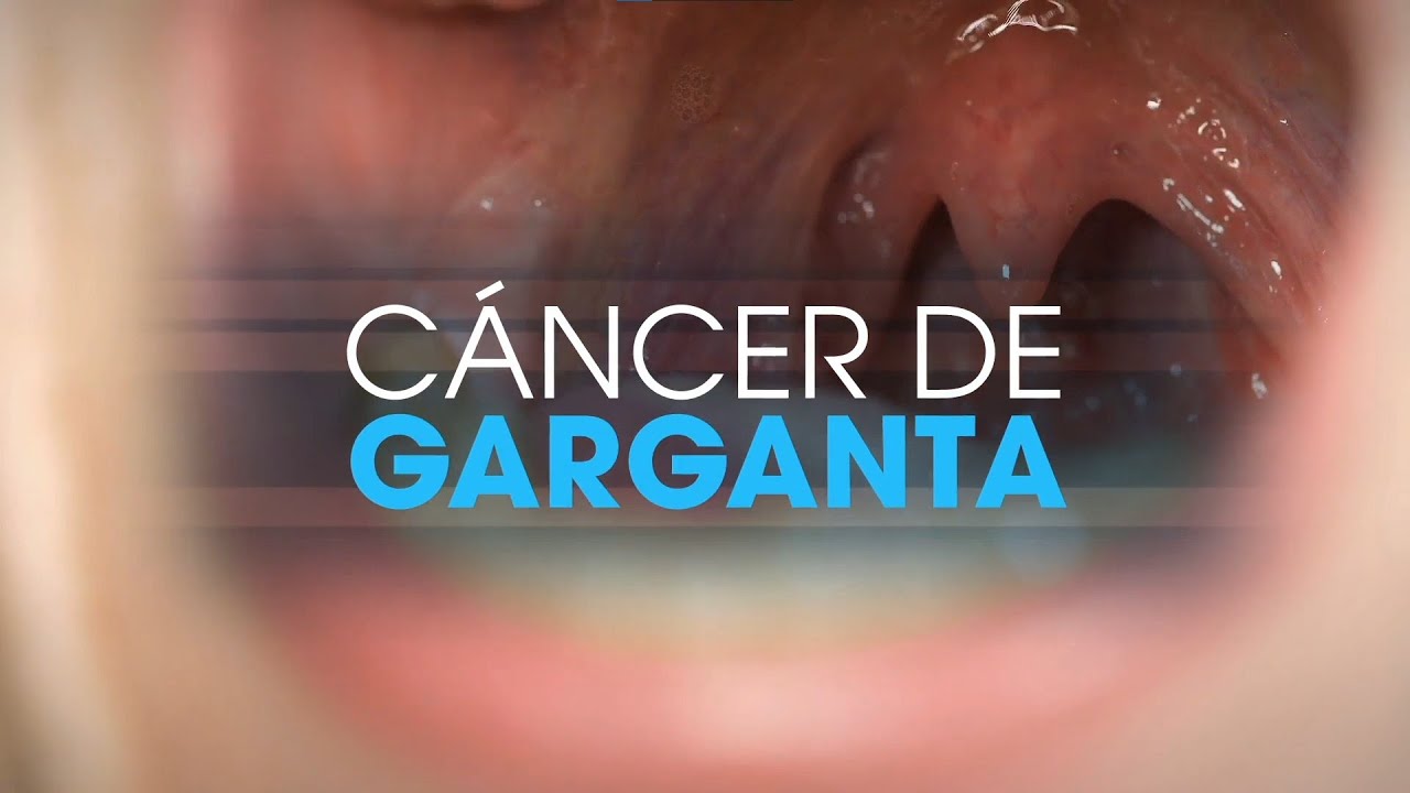 Cáncer de garganta | Pacientes TV - YouTube