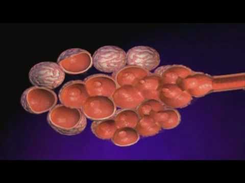 Emphysème - YouTube