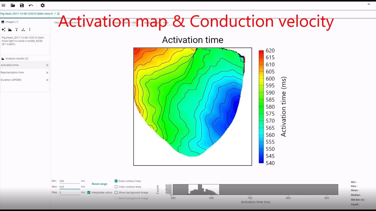 Activation map, Repolarization map and APD map by using BV Workbench ...