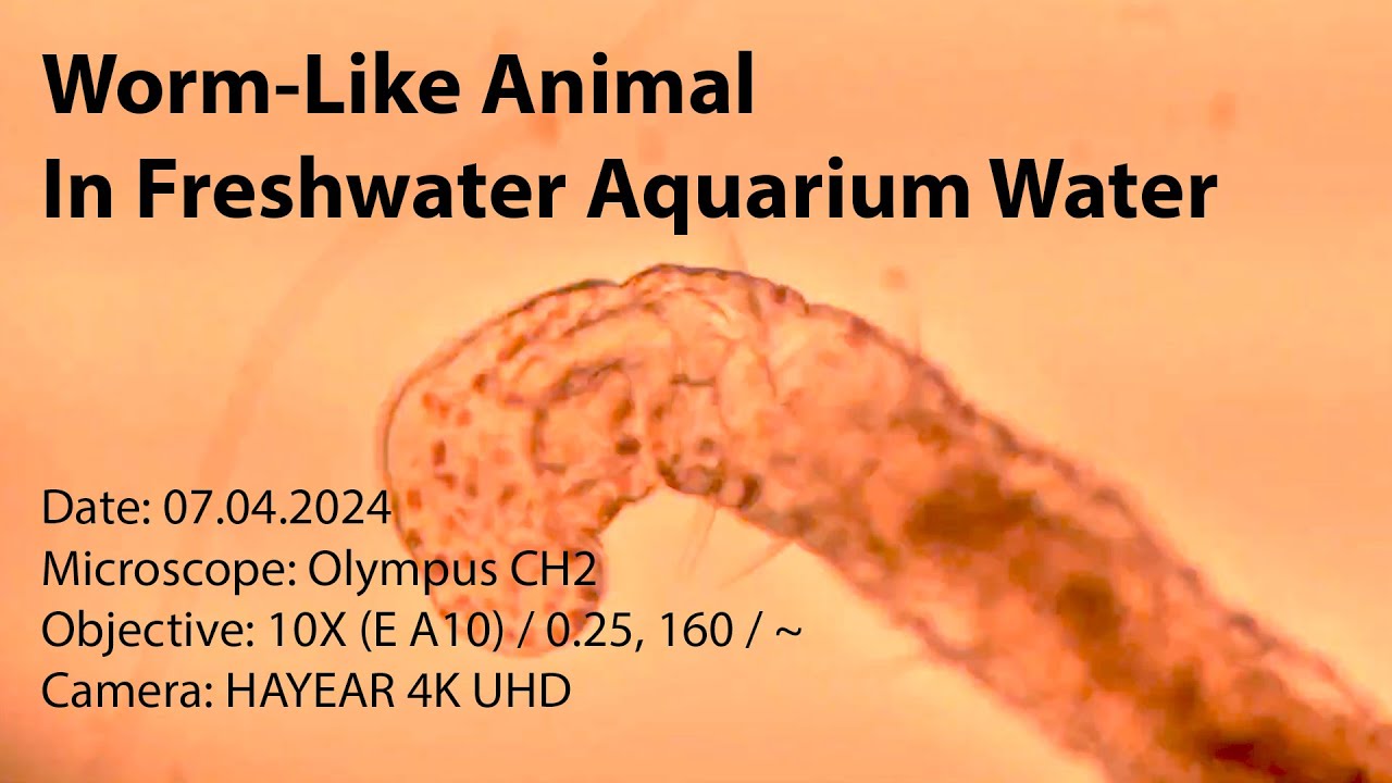 Microscopic Video Recording Of A Worm-Like Animal From My Aquarium ...