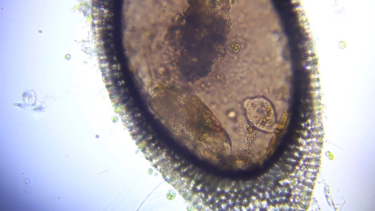 Rotifer stucked in bryozoan statoblast - YouTube