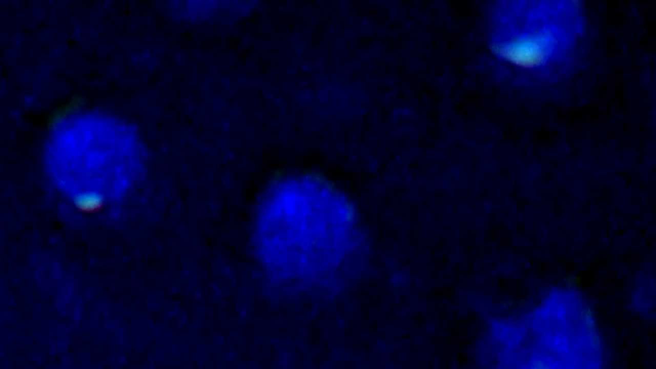 sphaeroeca volvox protozoos - YouTube
