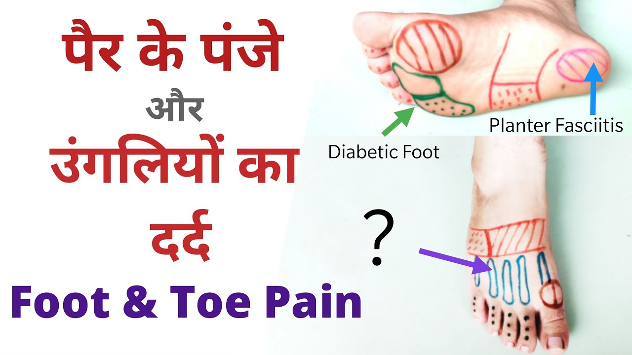 पैर के पंजे और पैर की उंगलियों का दर्द | Foot and toe pain |Dr. vivek ...