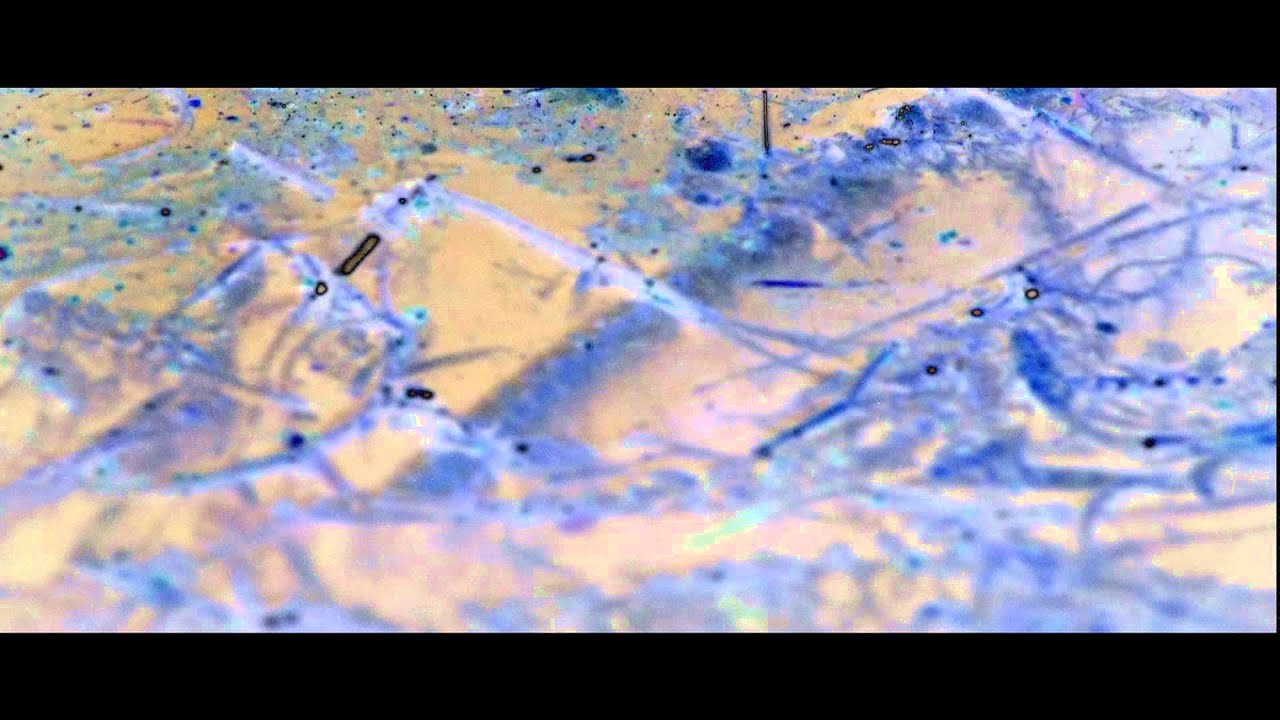 ffffffffff fffff - YouTube