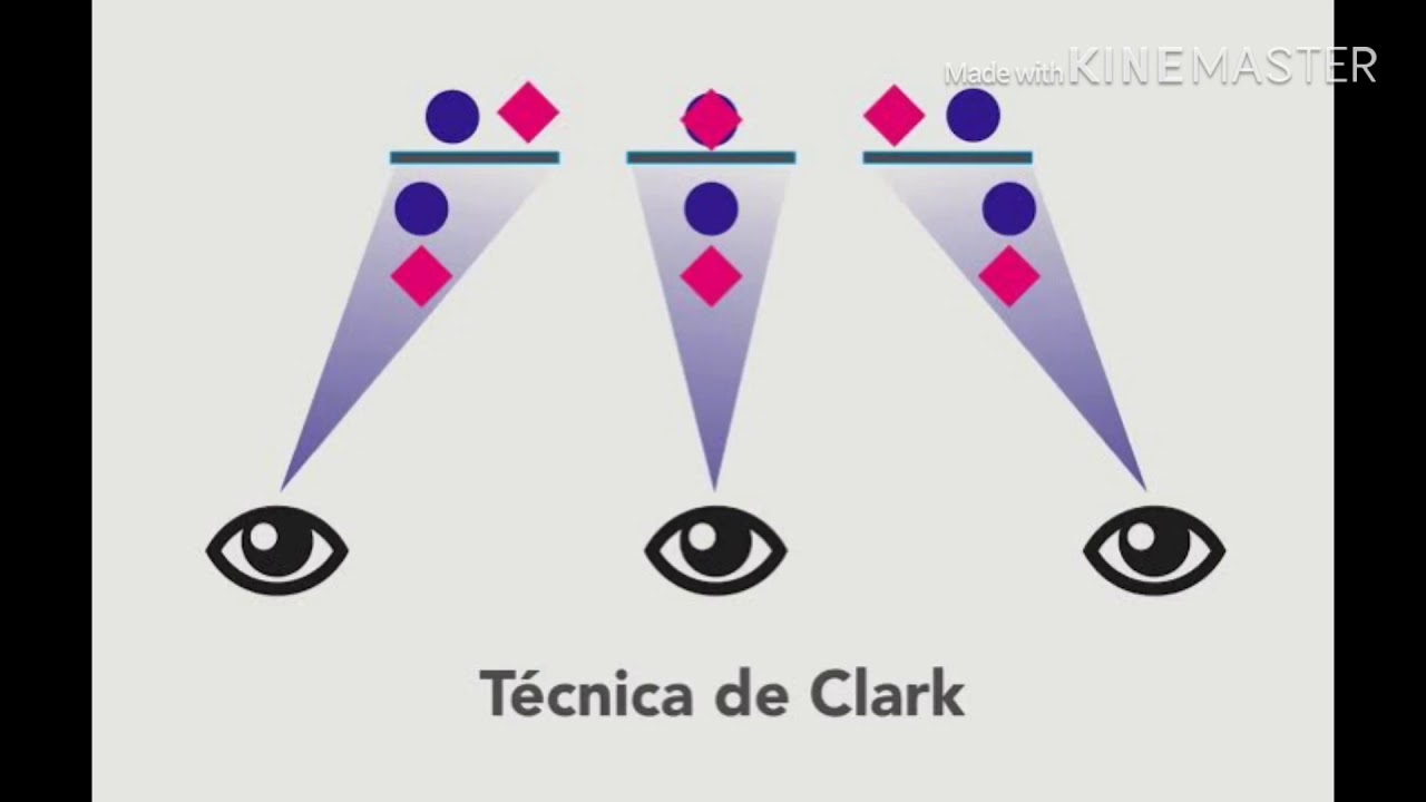 Funcionar Momento danés regla de clark radiologia electrodo Desde toma una foto