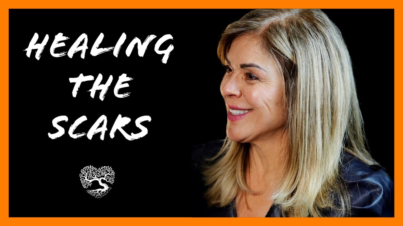 Abbie's Story - Healing the Scars, Embracing Wholeness (Part 2) - YouTube