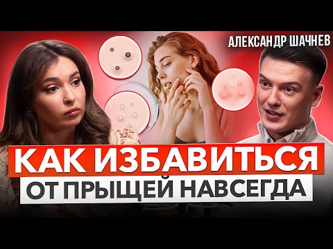 ПОДКАСТ НА ЧИСТУЮ КОЖУ: Акне и прыщи на лице - лечение, причины. 7 советов врача дерматолога.