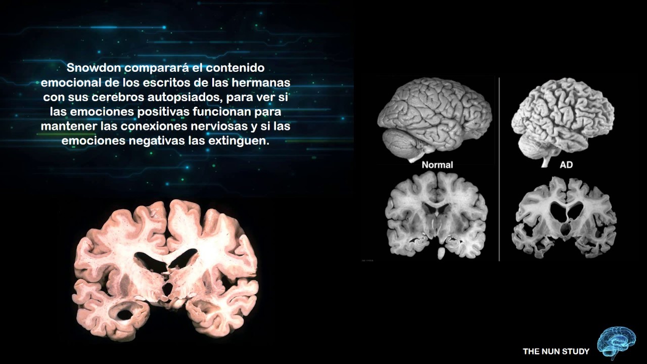 the nun study - YouTube