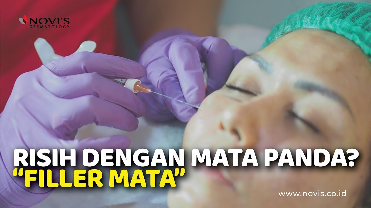 Solusi Mengatasi Mata Panda Dengan melakukan Treatment Ini - YouTube