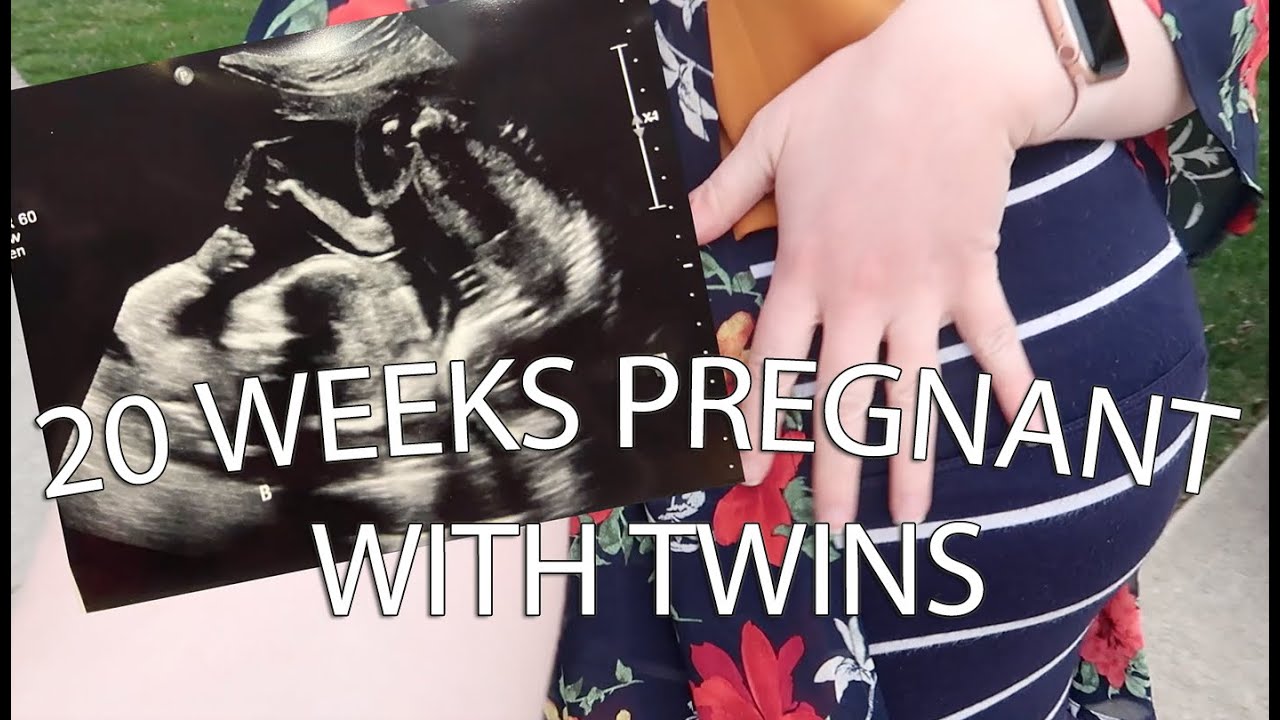 20 Weeks Pregnant With Twins | Anatomy Scan | Twin Nursery Plans | WFH ...
