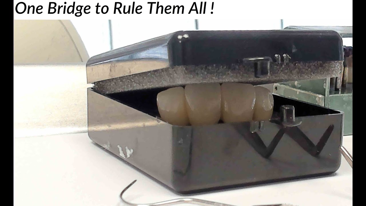 One Bridge to Rule Them All ! - YouTube