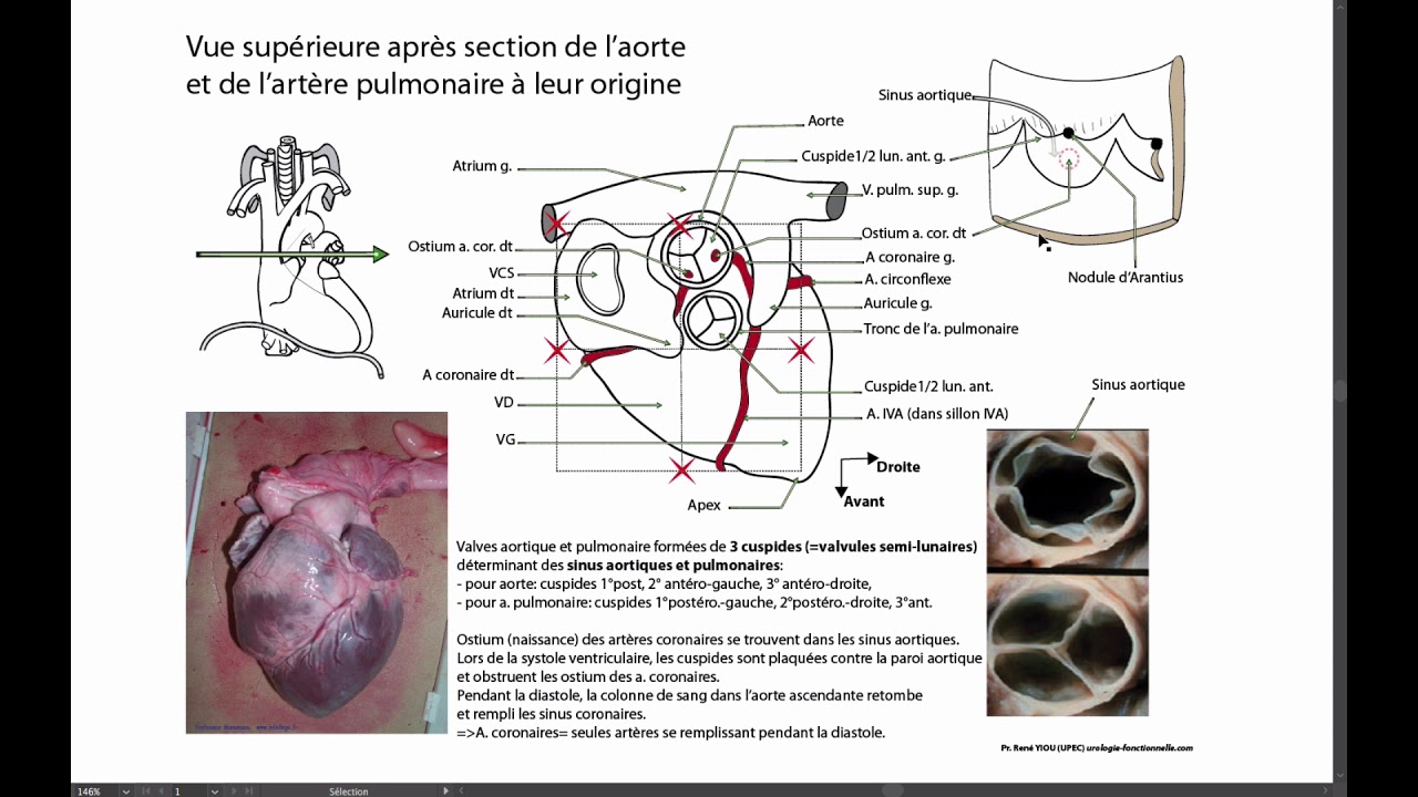 Vue supérieure du coeur orifices aortique et pulmonaire - YouTube