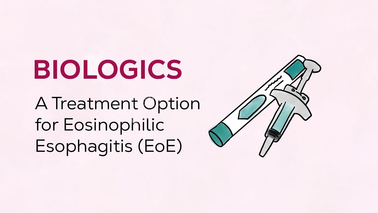 Biologics: A Treatment Option for Eosinophilic Esophagitis (EoE) - YouTube