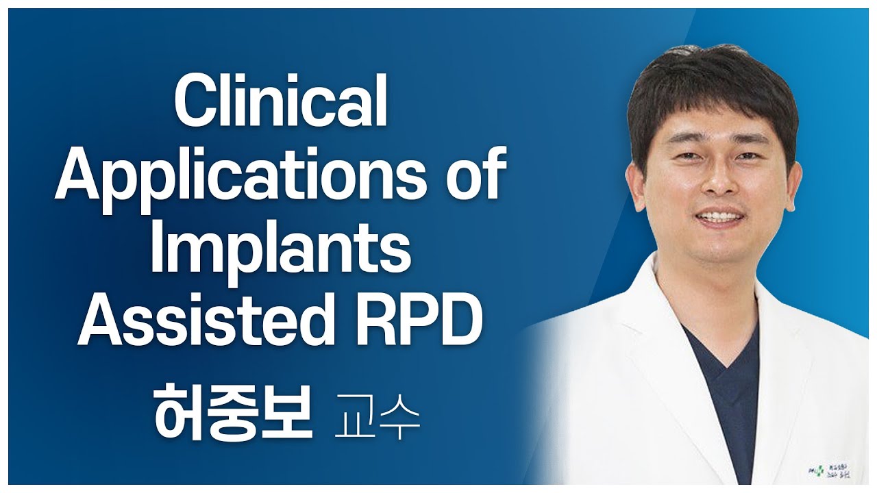 Clinical Applications of Implants Assisted RPD - YouTube
