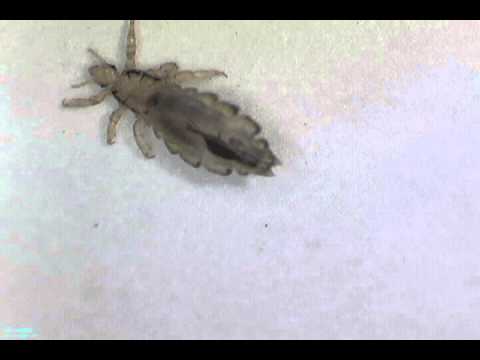 Head lice under a digital microscope - YouTube