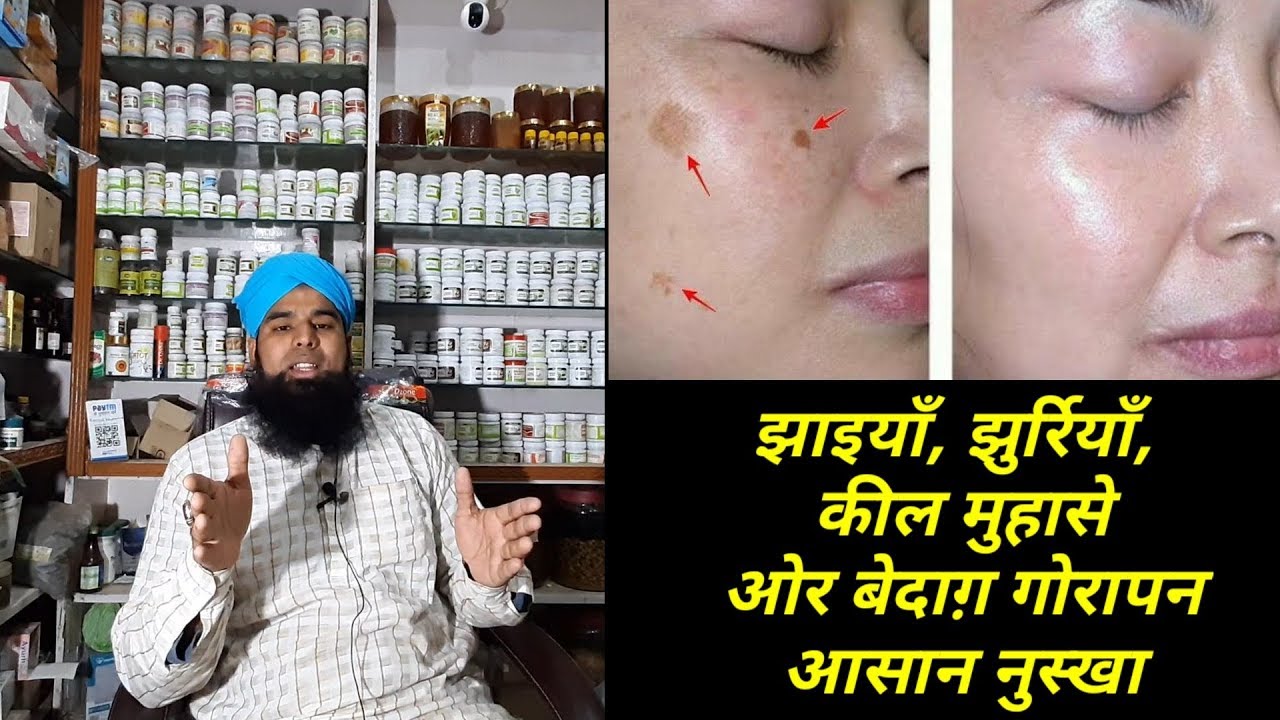 Skin problem चेहरे की झुर्रियाँ, दाग़,धब्बे, झाइयाँ, का इलाज - YouTube