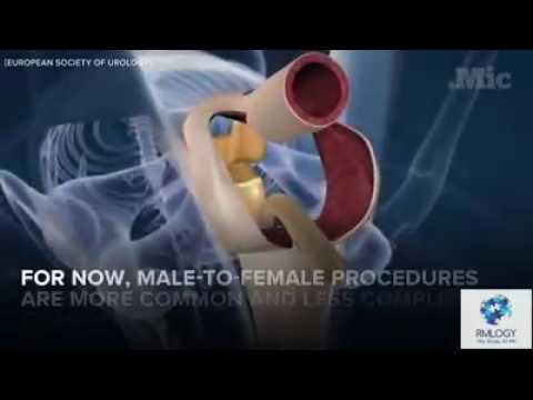 How male become female watch this - YouTube