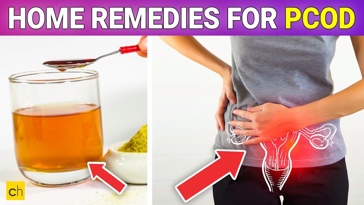 Best Home Remedies for PCOD - Credihealth - YouTube