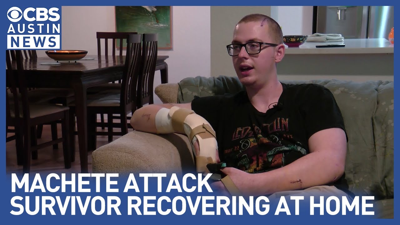 Austin machete attack survivor shares story of recovery - YouTube