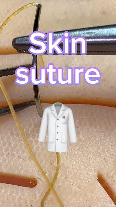Skin suture/Шов по Донати#medicine#doctor#surgeon#врач - YouTube