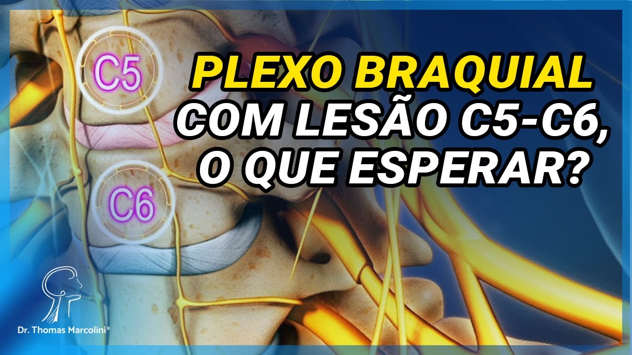 Lesão De Plexo Braquial C5 E C6 - RETOEDU