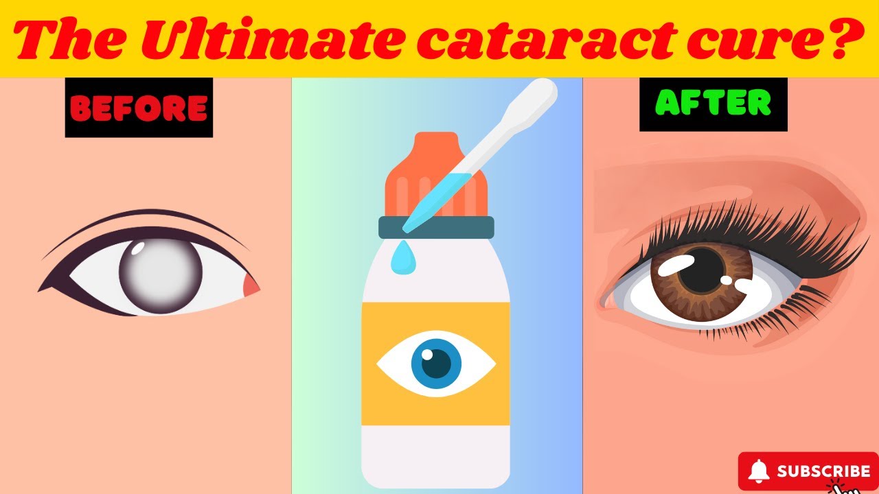 Miracle Cure for Cataracts or Risky Treatment? The Secret Eye Drop ...
