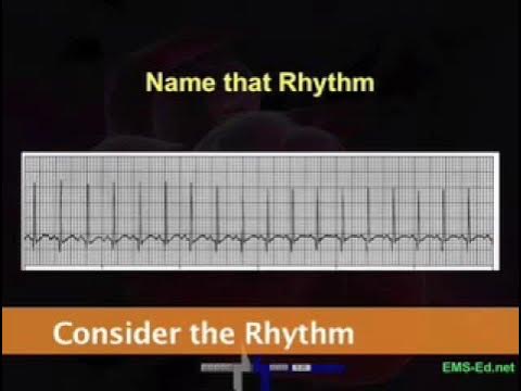 Intro EKG Interpretation Part 2 - YouTube