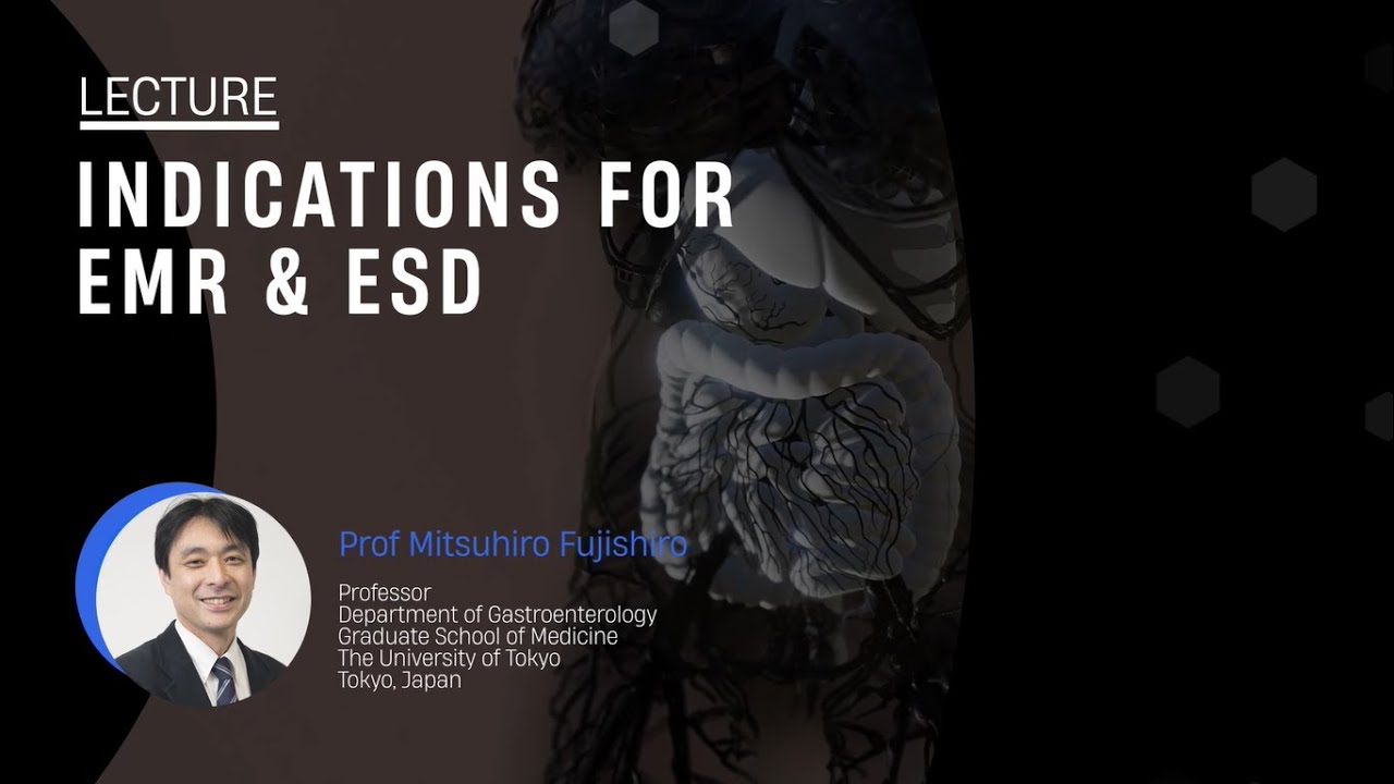 Indications for EMR & ESD (Prof. Mitsuhiro Fujishiro) - YouTube