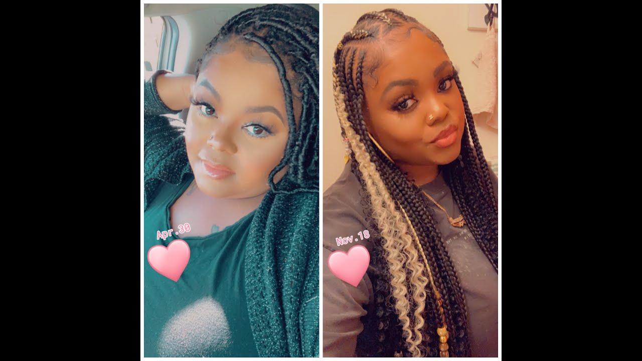 2 month post VSG update. Pros, Cons, etc! - YouTube